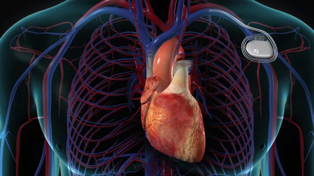 Pacemaker Implantation - Hrudayam Heart & Woman Care Clinic